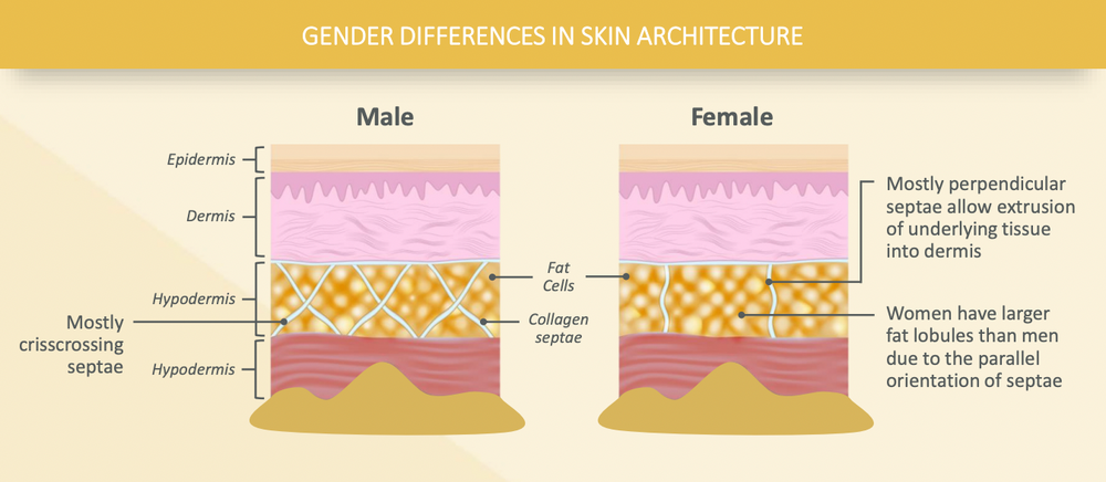 Want to Get Rid of Your Cellulite? Here’s What To Know